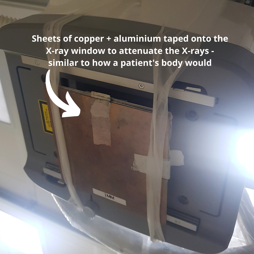 sheets-of-copper-aluminium-taped-onto-the-x-ray-window-to-attenuate-th ...